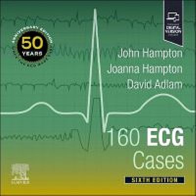 150 ECG Cases, 5th Edition Authors : John R. Hampton & David Adlam ...